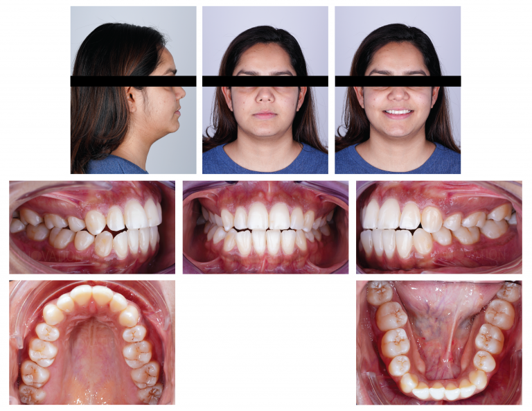 INNOVATION | Personalized Mechanotherapy: Simultaneous Correction of ...