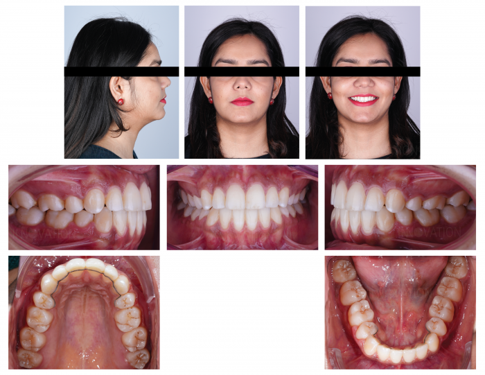 INNOVATION | Personalized Mechanotherapy: Simultaneous Correction of ...